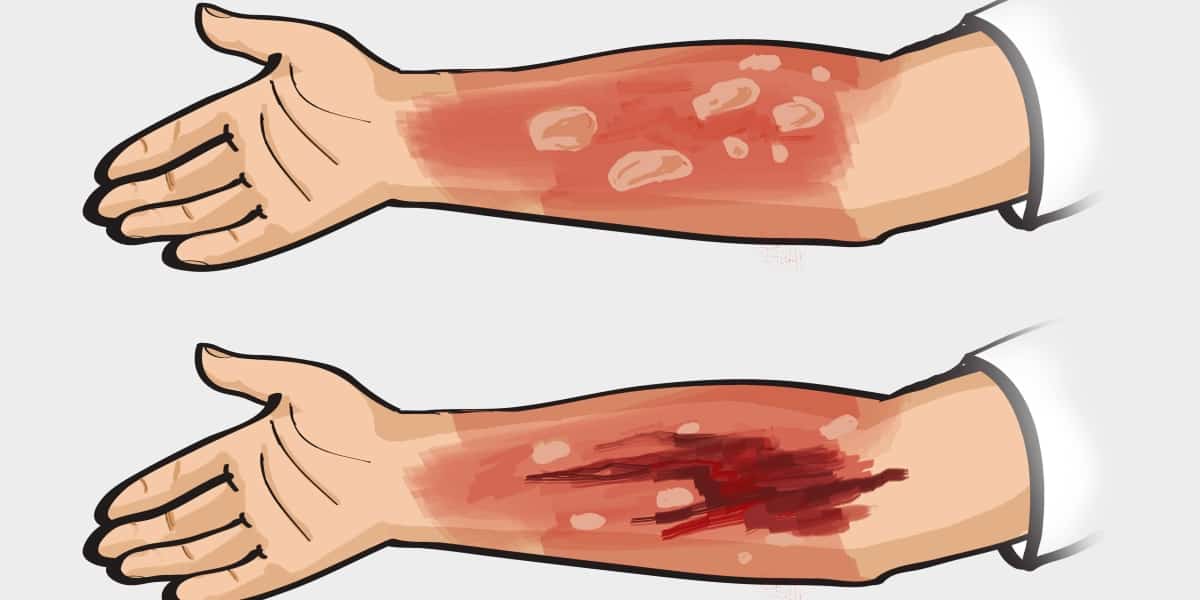 The Science of 35 Ancient Medical Practices Still In Use Today