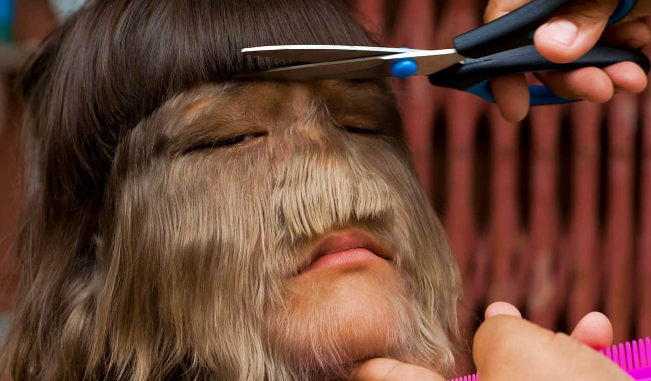 Rare Genetic Traits Most People Probably Do Not Have