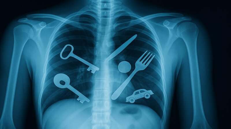 Top 15 Weirdest Things Scientists Have Ever Found Inside the Human Body ...
